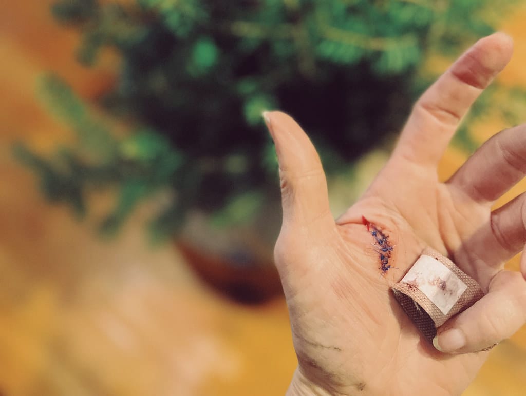 If Your Christmas Holds Some Sadness, Tears & Hardships - Ann Voskamp